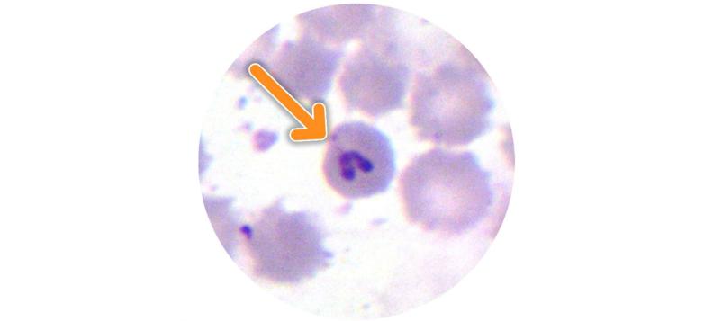 Babesia o babesiosis. Somosrumis Boehringer Ingelheim Animal Health España