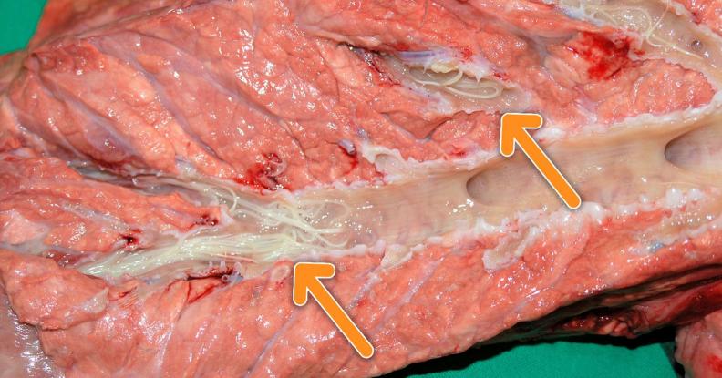 Dictyocaulus spp.Somosrumis Boehringer Ingelheim Animal Health España