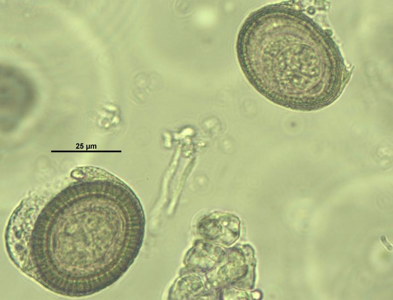Taenia saginata. Somosrumis Boehringer Ingelheim Animal Health España