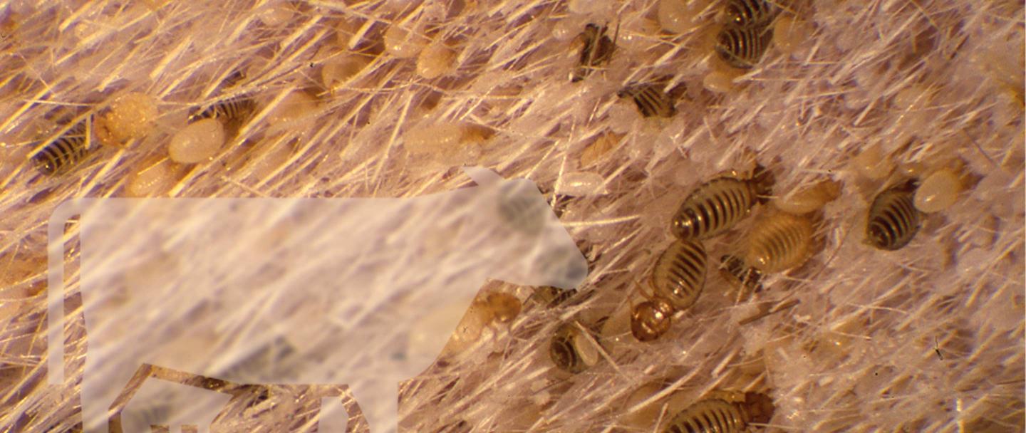 Piojos (pediculosis)
